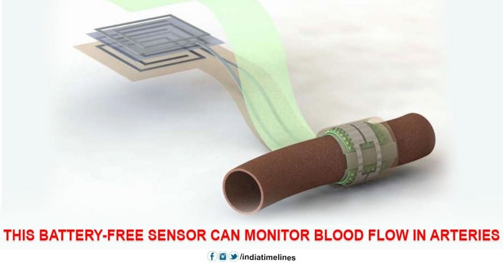 Biodegradable Sensor Can Monitor Blood Flow in Arteries | Indiatimelines