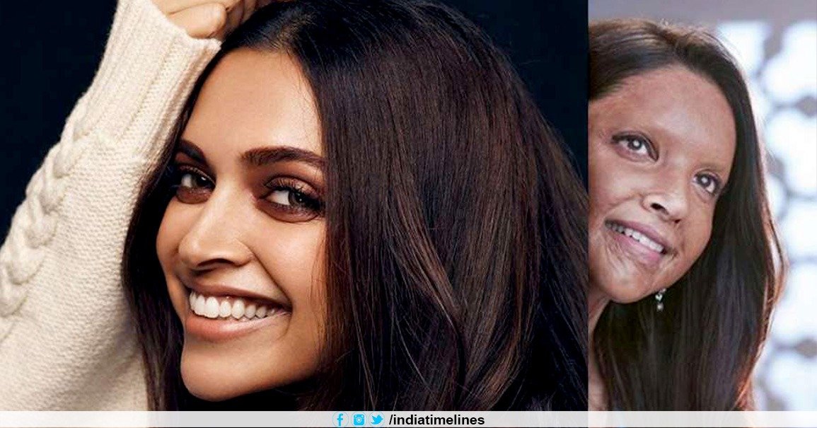 Chhapaak First Look, Deepika's Look as Acid Attack Survivor Revealed