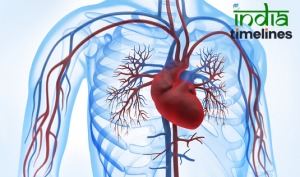Understanding Heart Surgery: Procedures, Preparation, Recovery